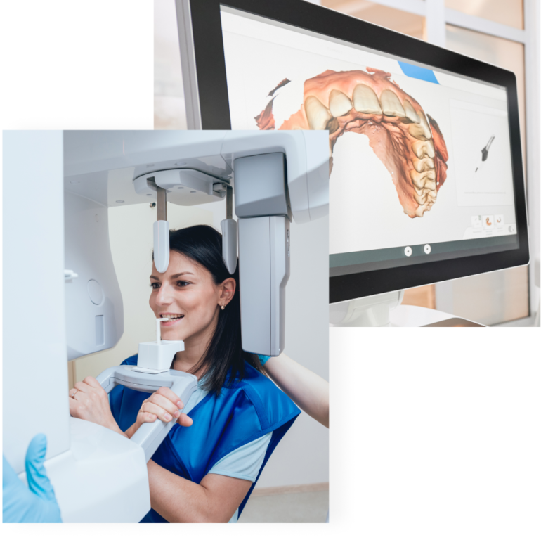 CBCT Scan - I like 2 Smile